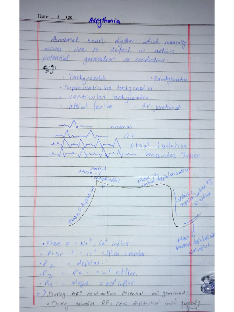 Arrythmia Rehan | PDF