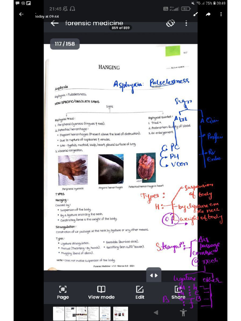 HANG,INJ,ID FMT | PDF