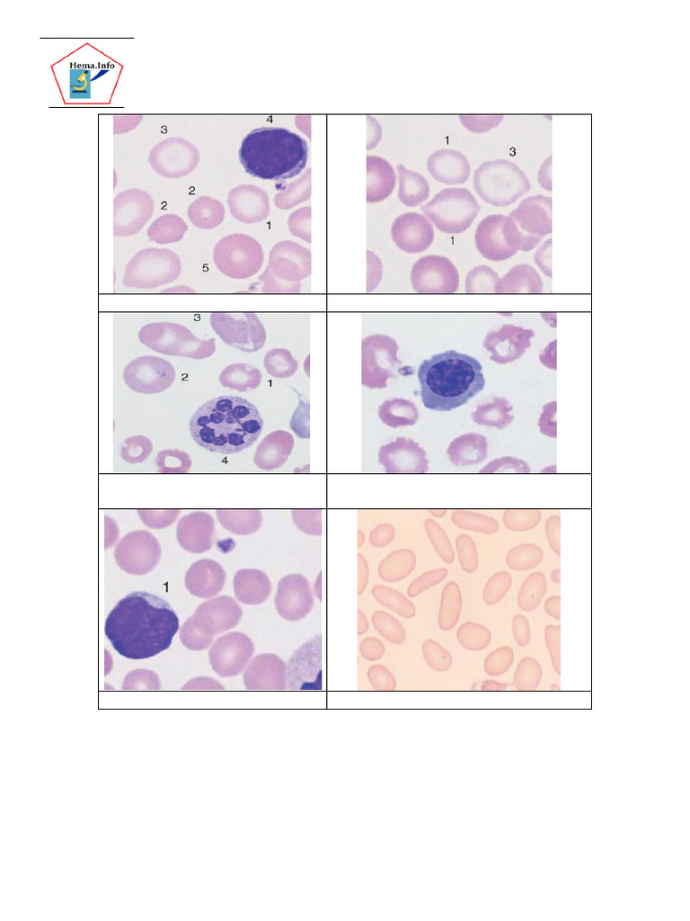 Mini Atlas RBC 1 (1) | PDF