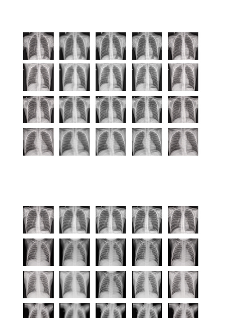 Lungs | PDF