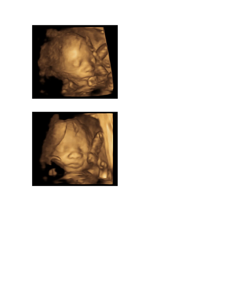 Davi 3D | PDF