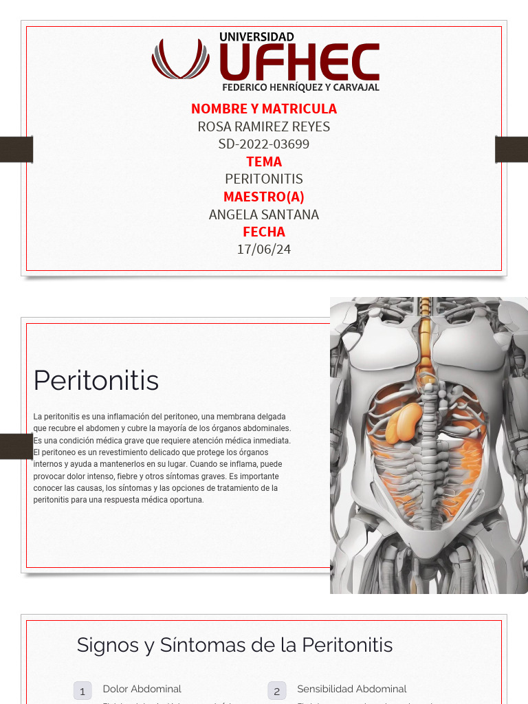 Diapositiva Peritonitis | PDF