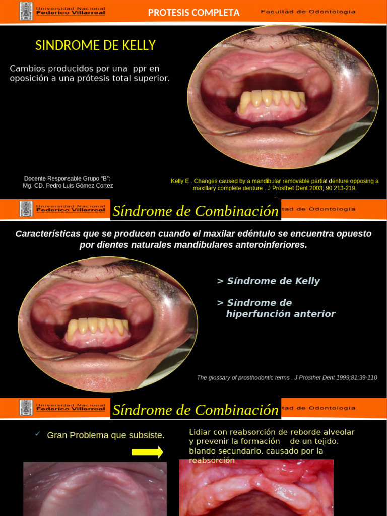 7 Clase 7. Sindrom de Kelly | PDF
