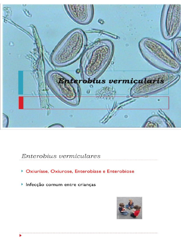 Enterobius Vermiculares - 1725884290 | PDF