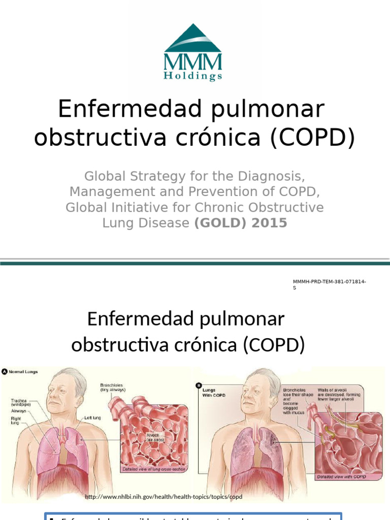 Handout COPD 11-2016 | PDF