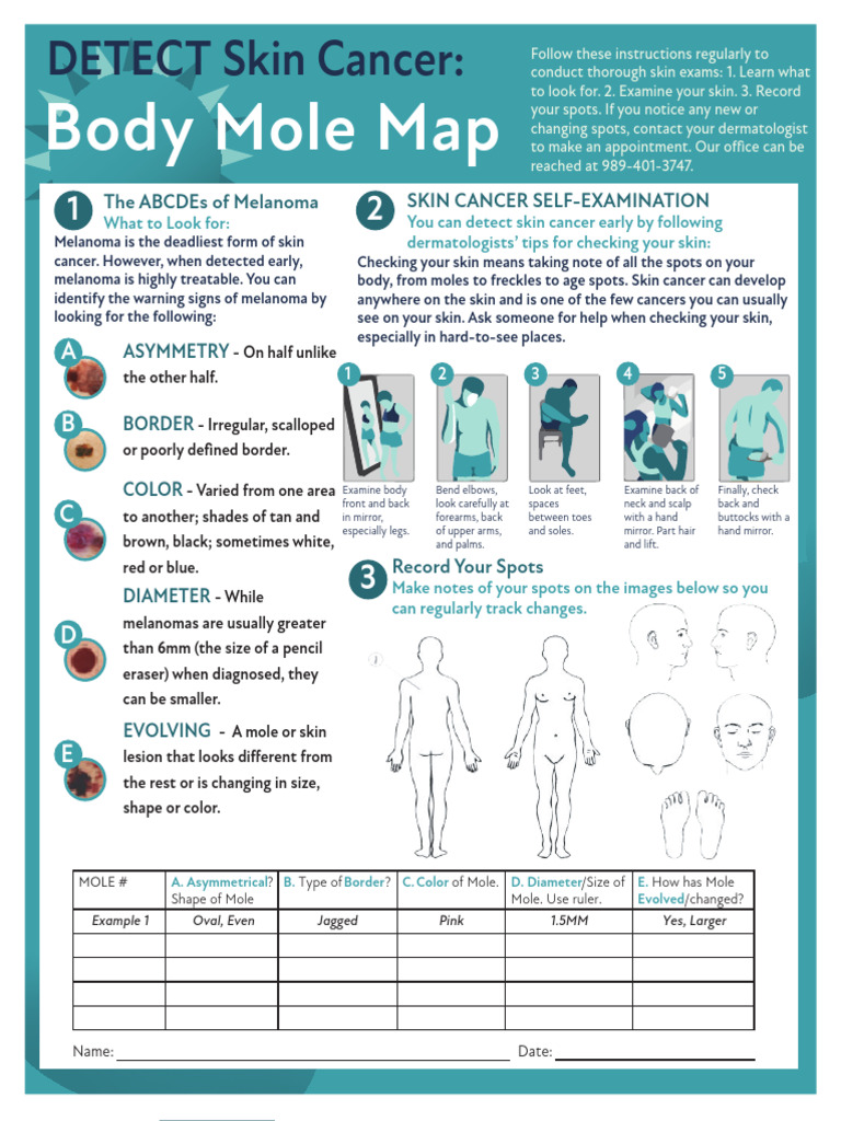 Detect Skin Cancer Body Mole Map | PDF | Skin Cancer | Sunscreen