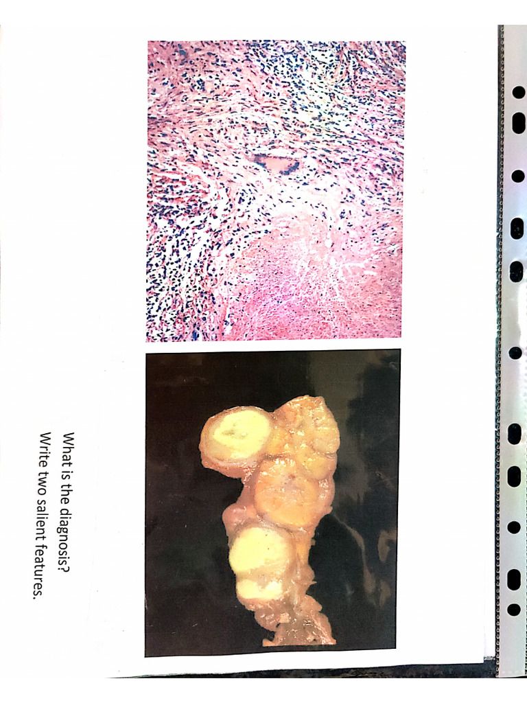 Patho Spottersss | PDF