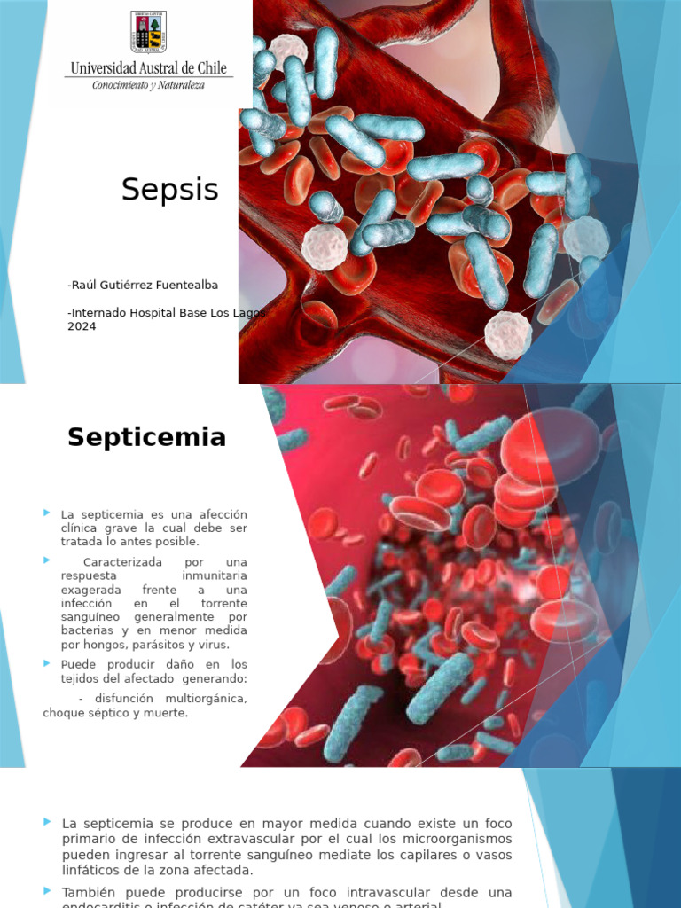 Sepsis | PDF