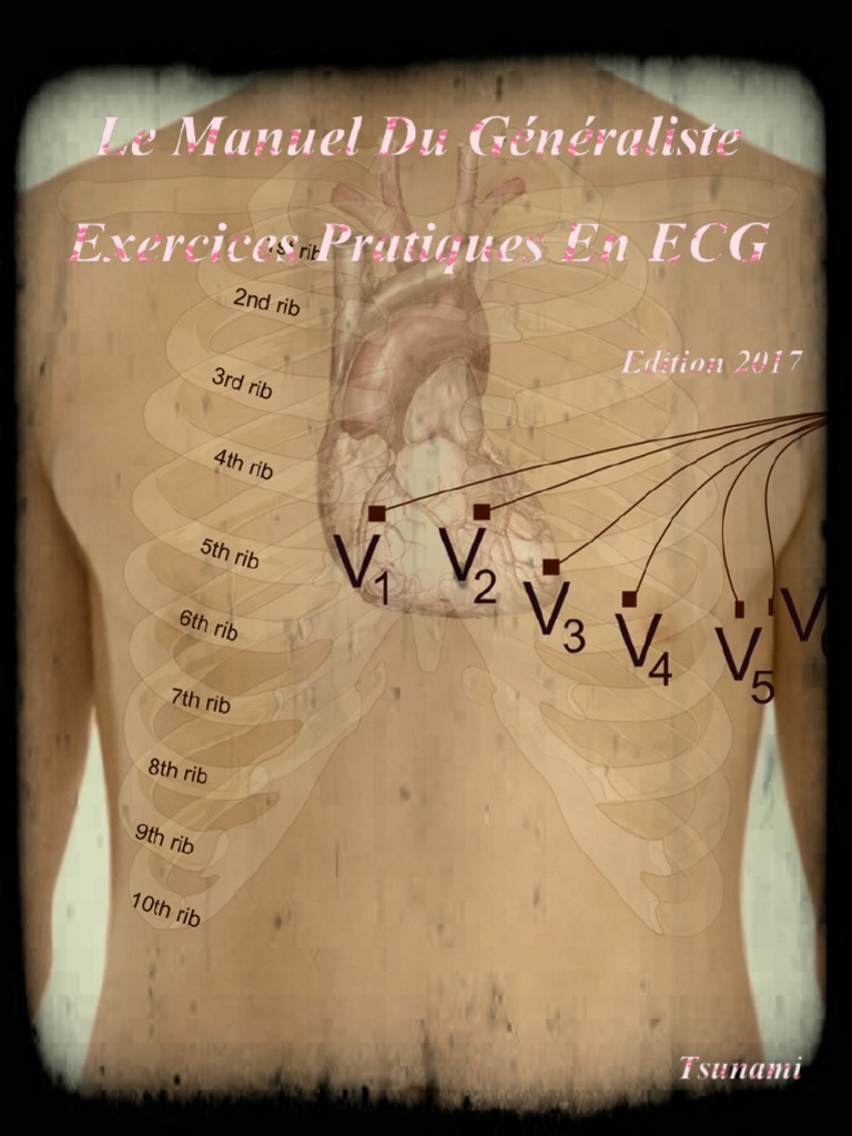 Exercices Pratiques en ECG 2017 Edtions Tsunami | PDF
