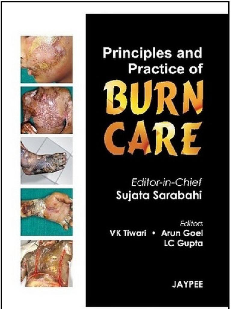 Principles and Practice of Burn Care | PDF