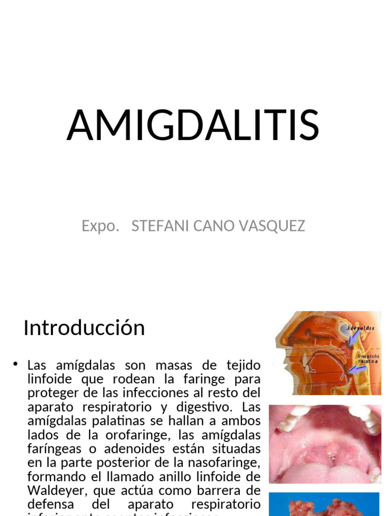 AMIGDALITIS | PDF