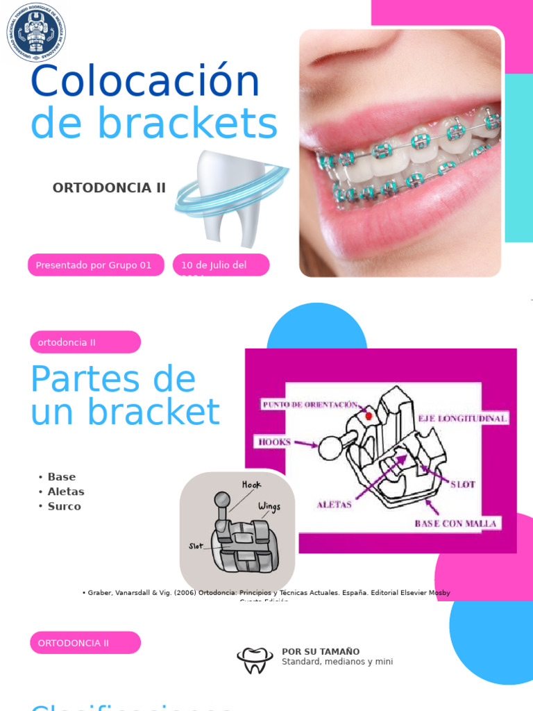 Brackets de Ortodoncia | PDF