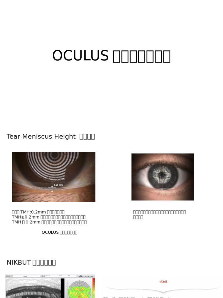OCULUS眼表综合分析仪 | PDF