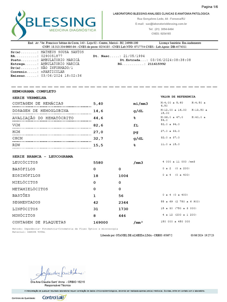 Laudo de Exame - Hemograma Completo Matheus Sousa Santos | PDF