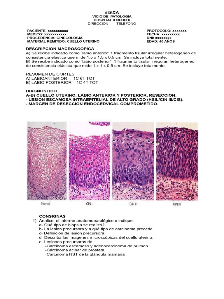 Informe Anatomo Patologico | PDF