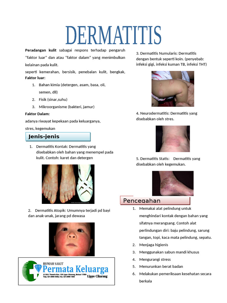 Poster Dermatitis | PDF