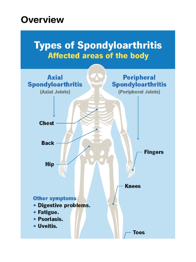 Axial Spondyloarthritis - Symptoms & Treatment | PDF