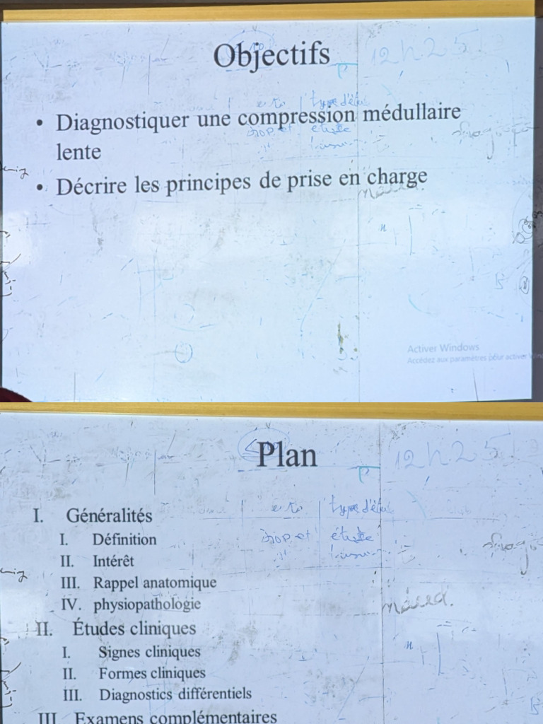 SD de Compression Médullaire Lente | PDF