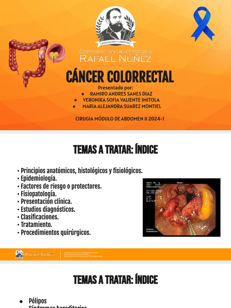 Cancer Colorectal | PDF