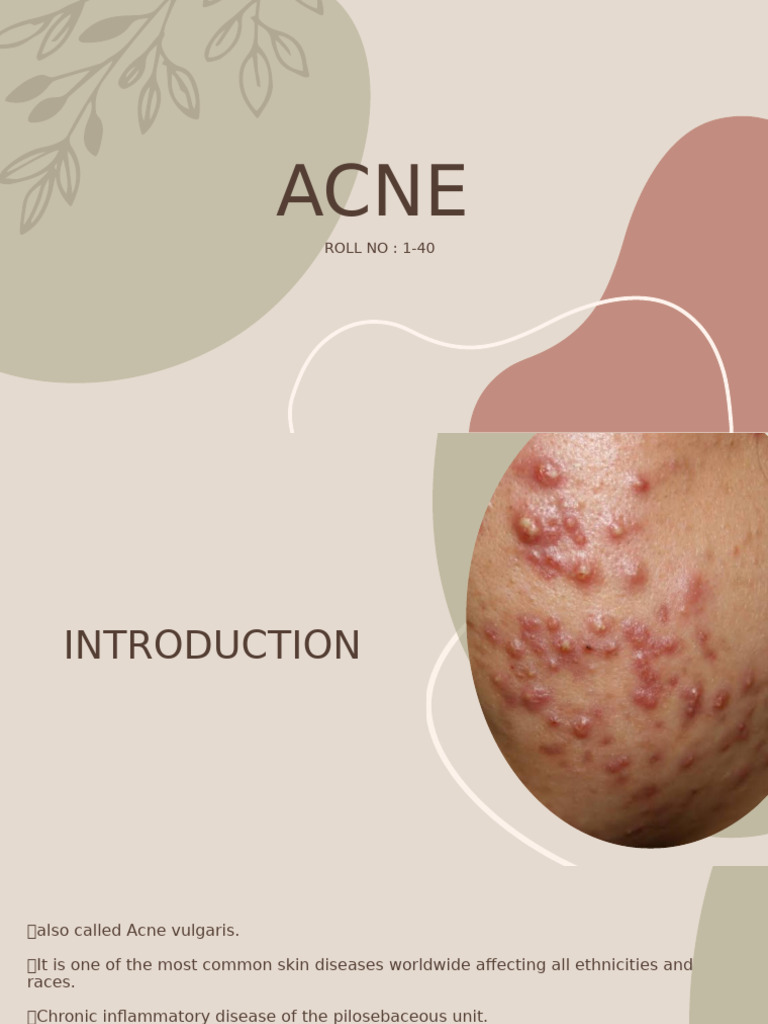 Acne | PDF
