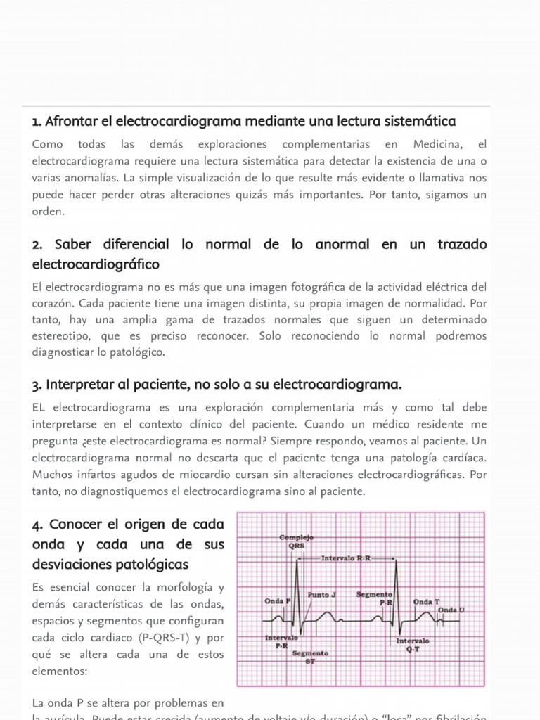 Cómo Interpretar Un EKG | PDF