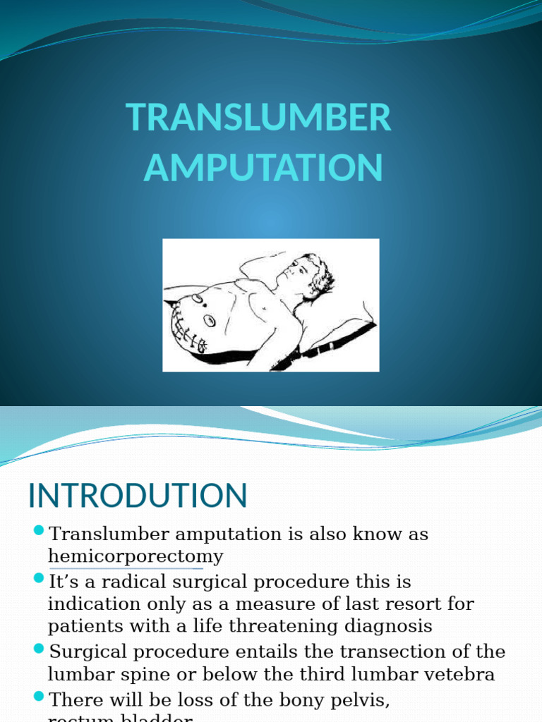 Translumber Amputation | PDF