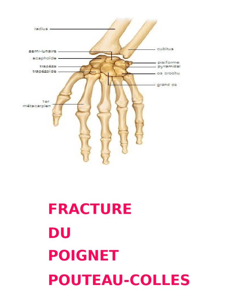 Acture Potteau Colles | PDF