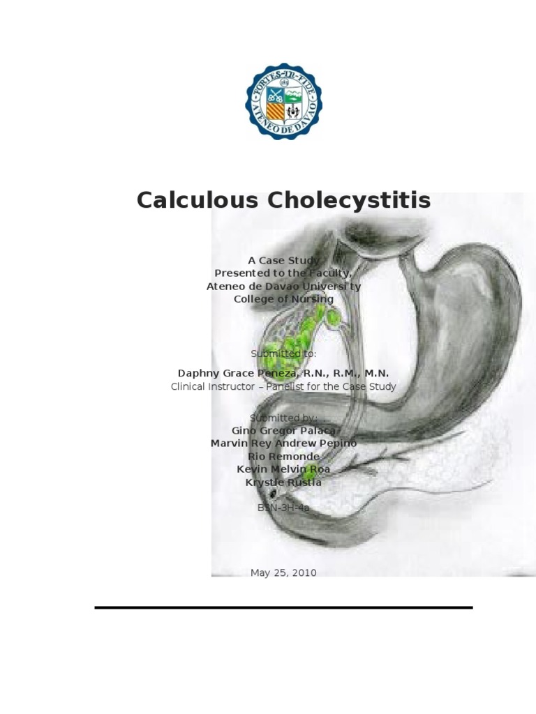 Calculous-Cholecystitis | Bile | Gallbladder