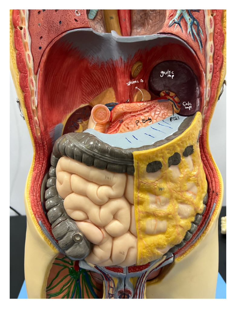 Spleen , Pancreas, Intestine and Wall | PDF