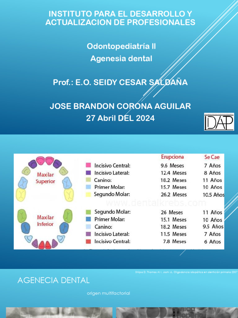 Anodoncia Dental Odontopediatria | PDF | Ortodoncia | Diente