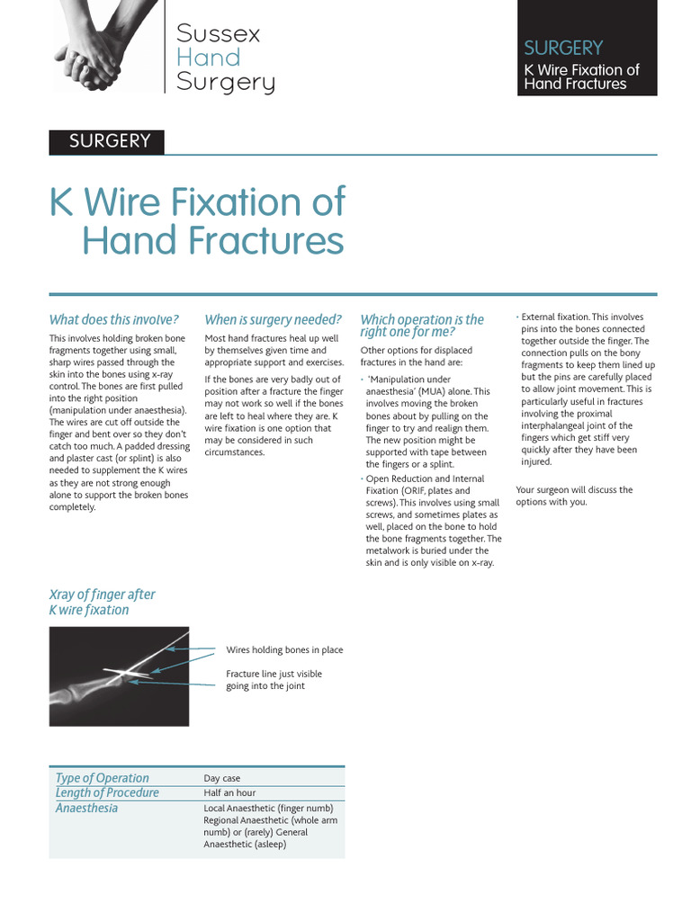K Wire Fixation for Hand Fractures | PDF | Hand | Surgery