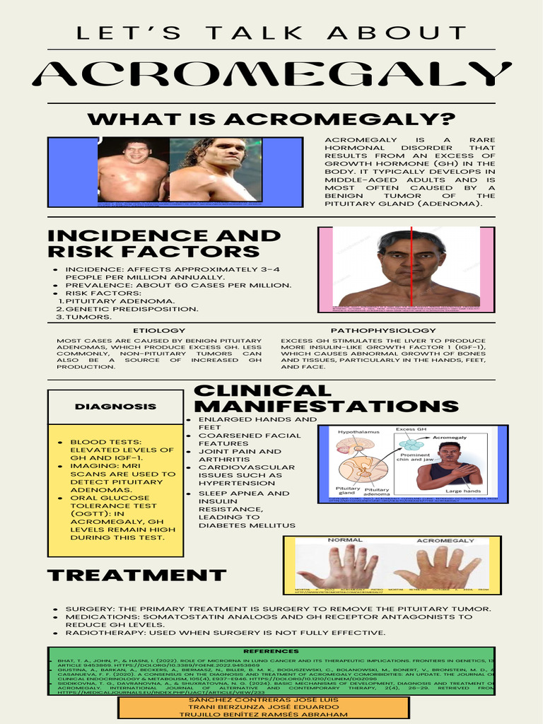 Acromegaly | PDF