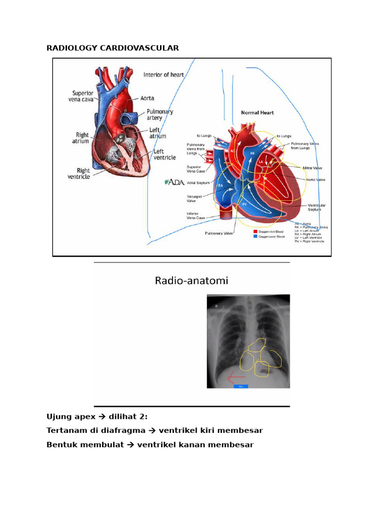 Radiology Cardiovascular | PDF