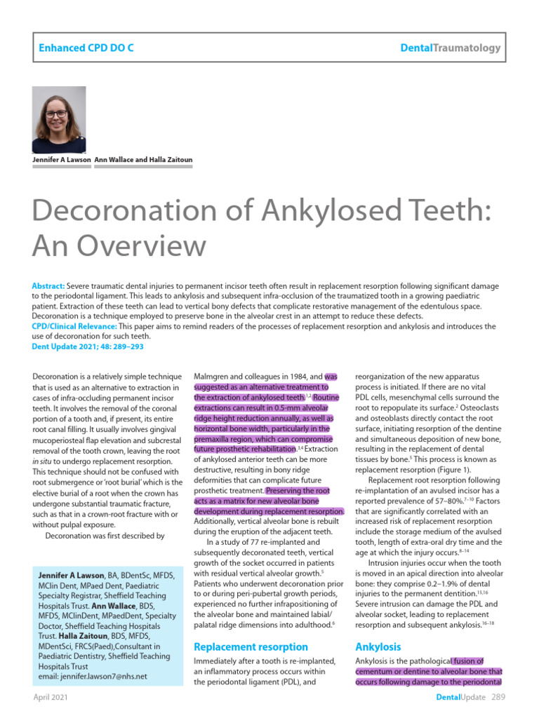 Lawson Et Al 2021 Decoronation of Ankylosed Teeth An Overview | PDF
