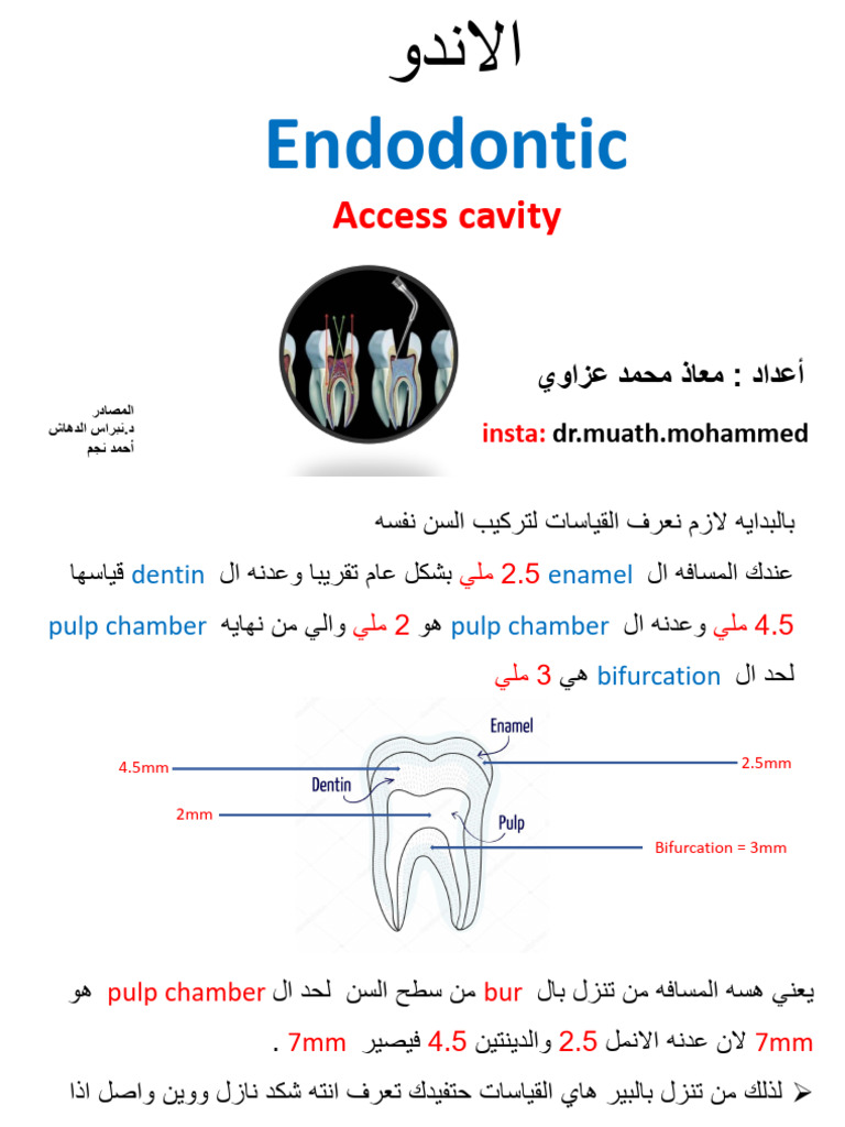 Access Cavity Endo | PDF