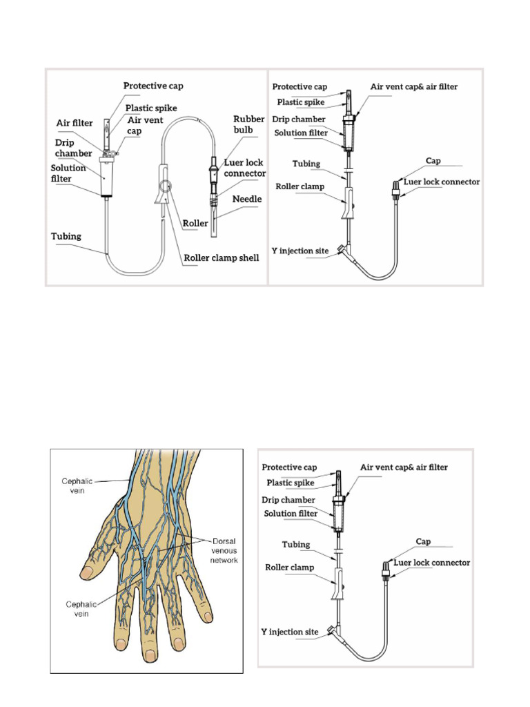 IV Set Parts & Common Site | PDF