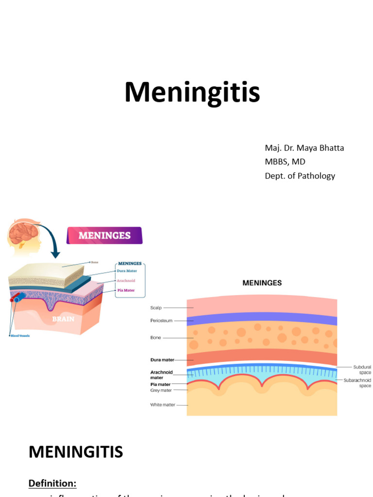 Meningitis - MBBS | PDF