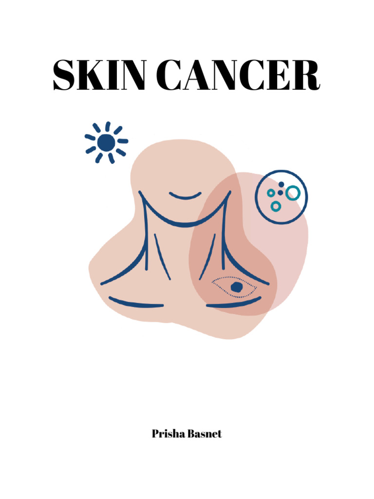 Skin Cancer | PDF
