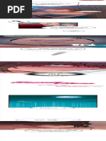 Akane Wa Tsumare Somerareru | PDF