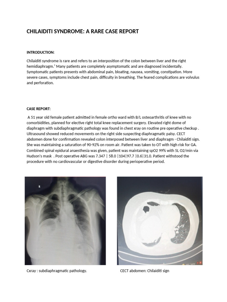 Chilaiditi Syndrome | PDF