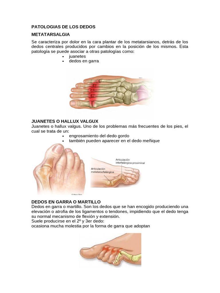 Patologias de Los Dedos | PDF