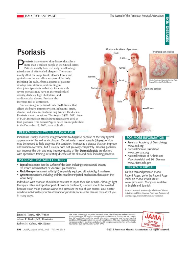Psoriasis | PDF