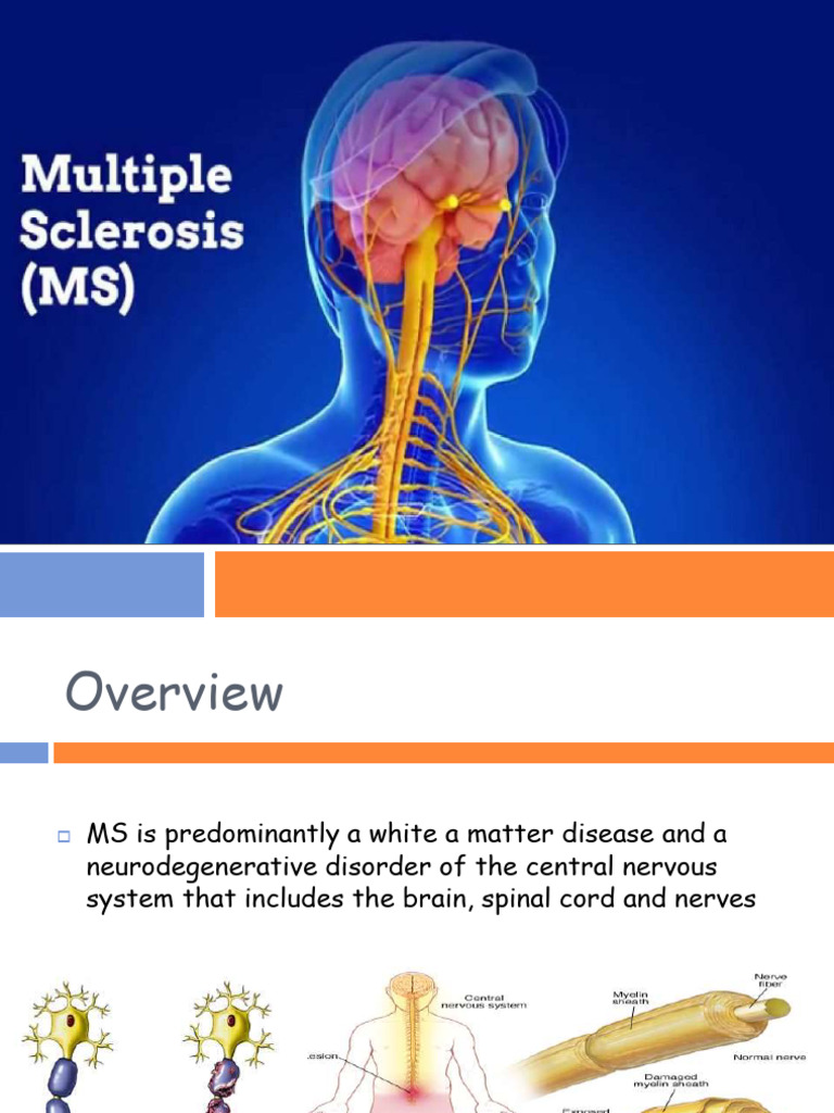 Multiplesclerosis 171219042211 | PDF