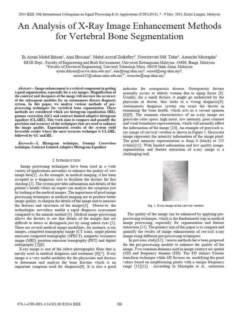 An Analysis of X-Ray Image Enhancement Methods For Vertebral Bone Segmentation | PDF