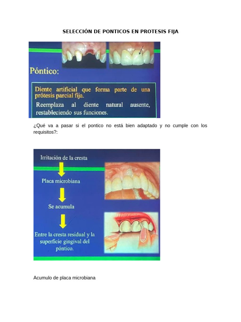 Selección de Pónticos en PF | PDF