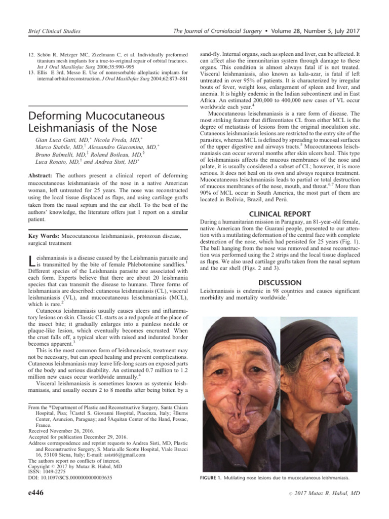 Deforming Mucocutaneous Leishmaniasis of The N | PDF