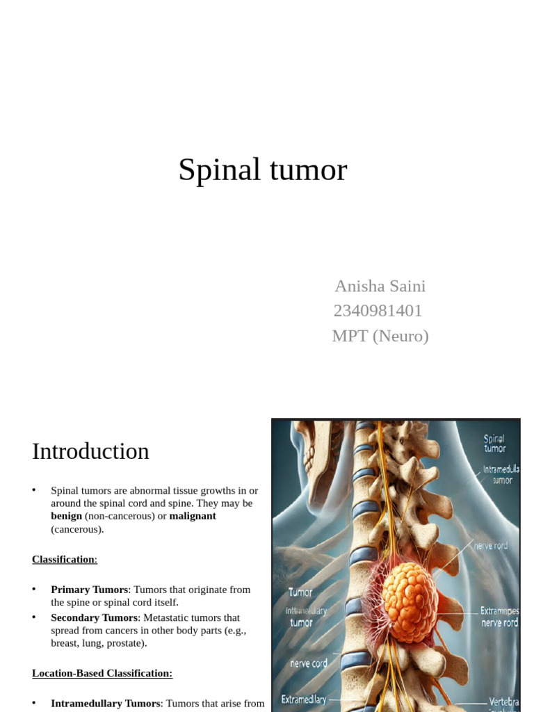 Spinal Tumor | PDF