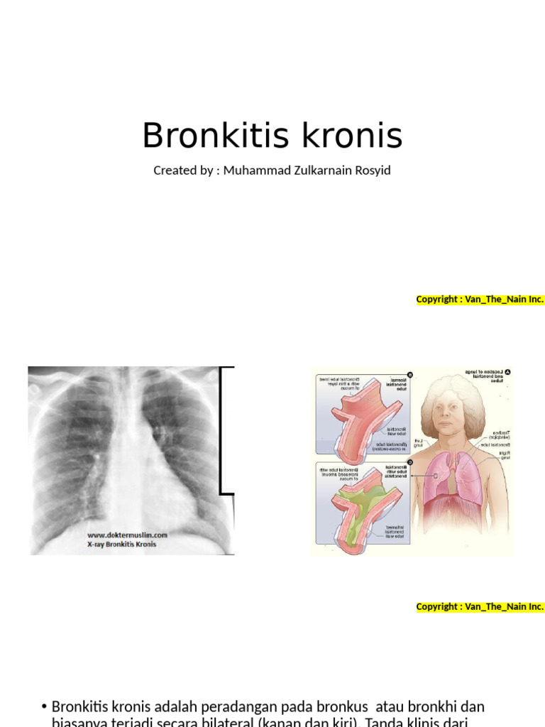 Bronkitis Kronis | PDF