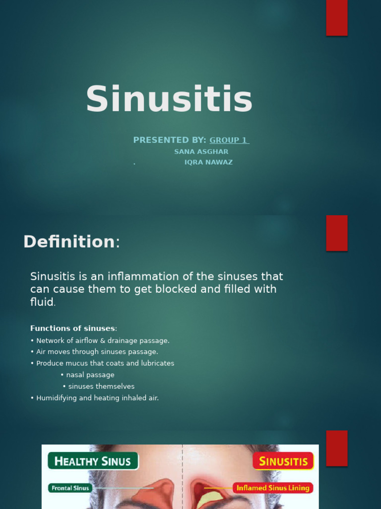 Sinusitis | PDF