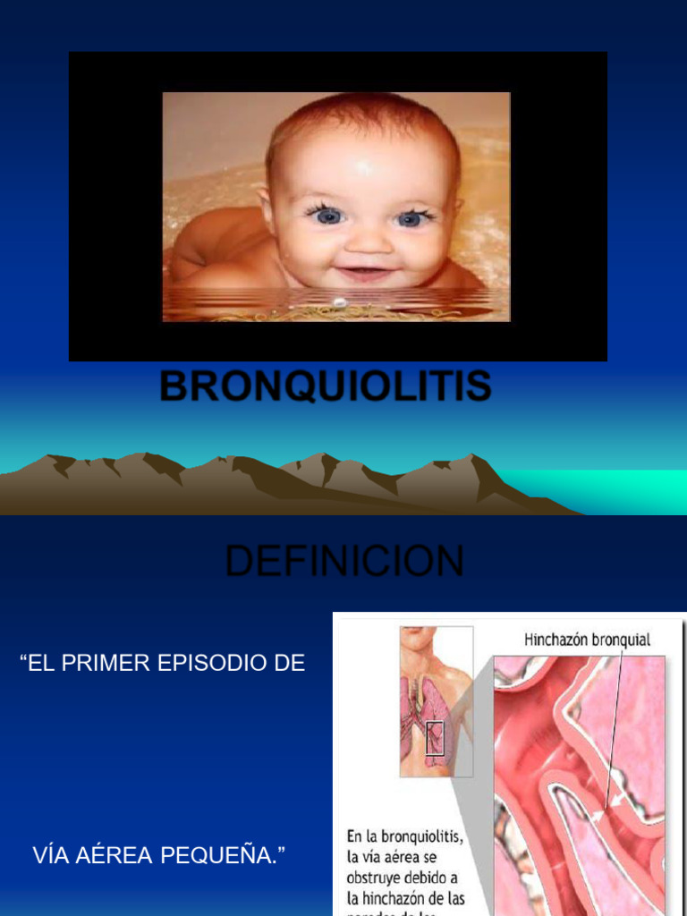 brionquiolitis | PDF